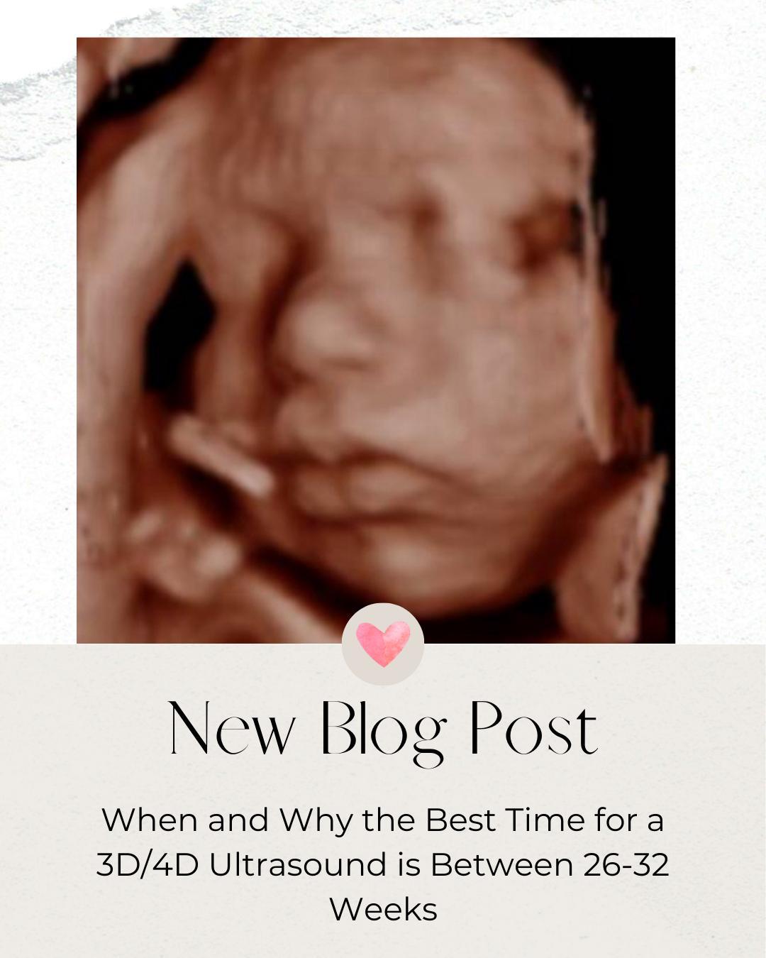When and Why the Best Time for a 3D/4D Ultrasound is Between 26-32 ...